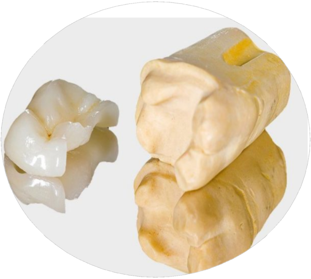 Superior Quality Dental Prosthesis | Dentist Marrakech
